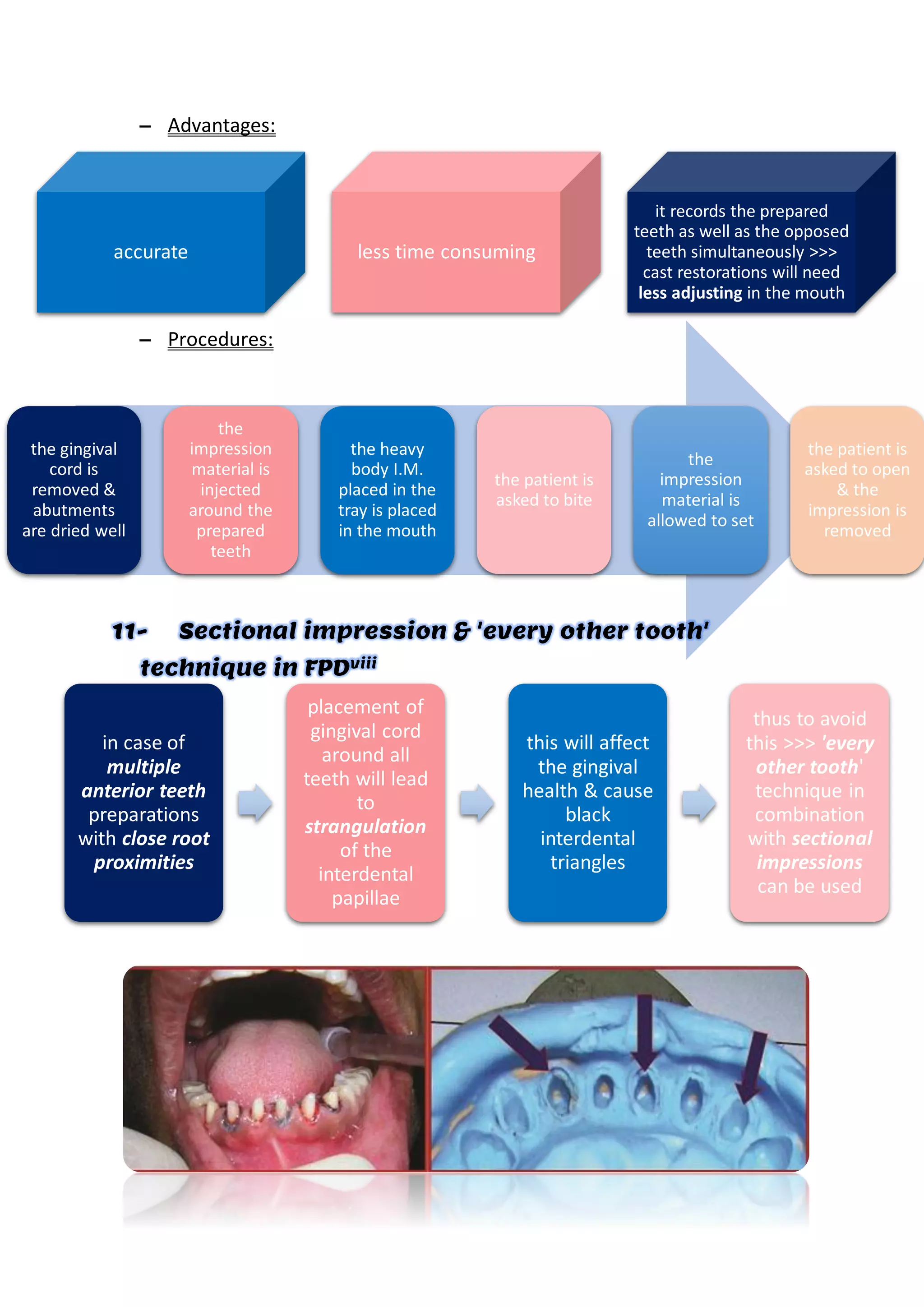 impression techniques for FPD | PDF
