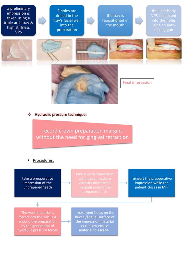 impression techniques for FPD | PDF | Oral care | Personal Care