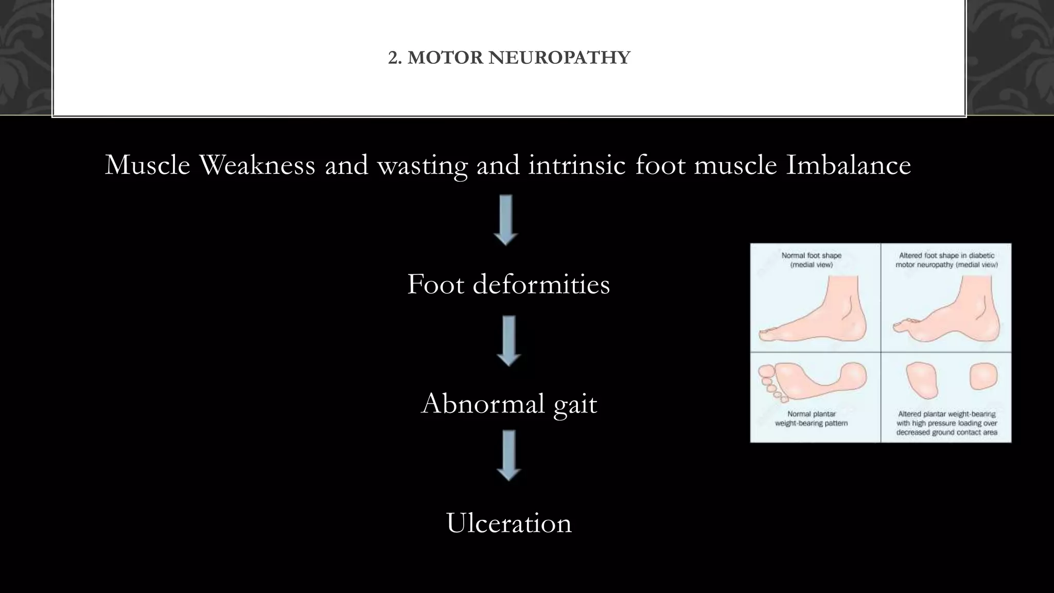 Diabetic Foot Sepsis | PPTX