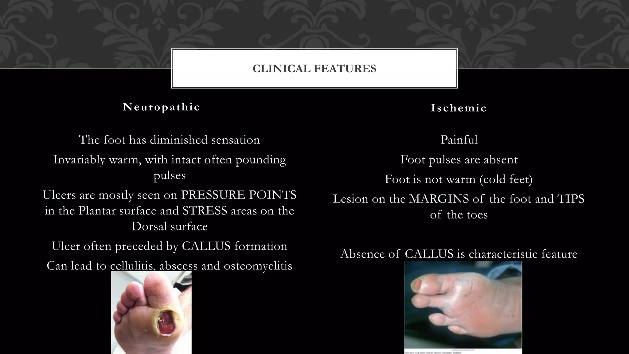 Diabetic Foot Sepsis | PPTX