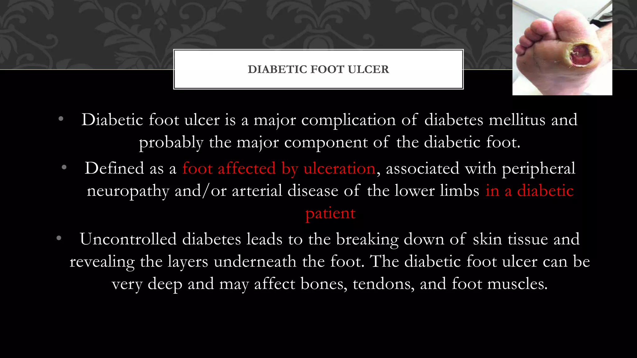 Diabetic Foot Sepsis | PPTX
