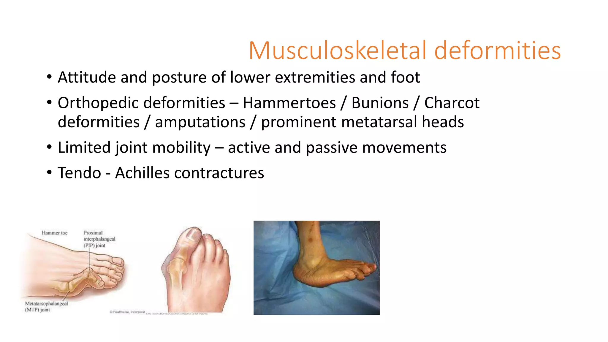 DIABETIC FOOT ULCER | PPTX