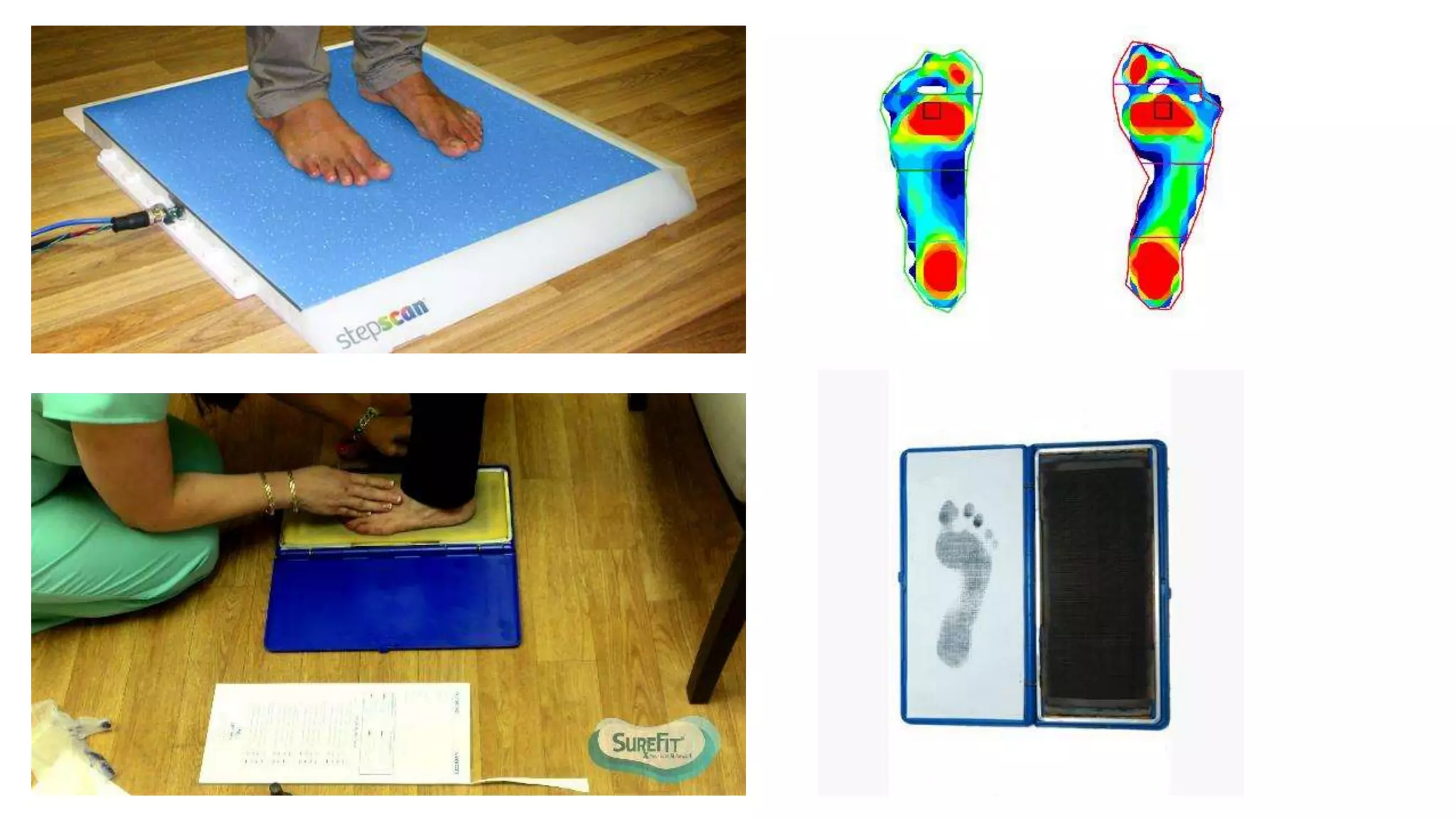DIABETIC FOOT ULCER | PPTX