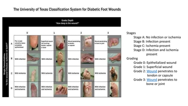 DIABETIC FOOT ULCER | PPTX | Foot Health | Diseases and Conditions