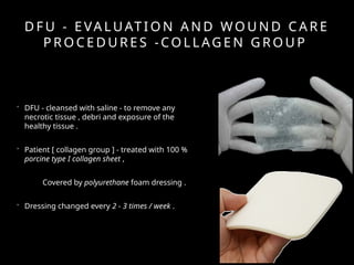 Diabetic foot ulcer - usage of collagen dressing for treatment | PPTX