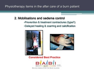 babi-20-burn-scar-and-rehabilitation-2.ppt | Physical Therapy | Wellness