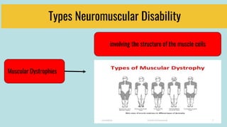 Children with Neuromuscular Diversities /Disability | PPTX