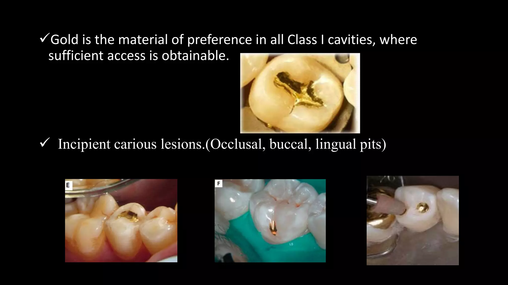 Direct Filling Gold | PPTX