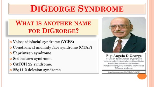 DiGeorge Syndrome (DGS).pdf