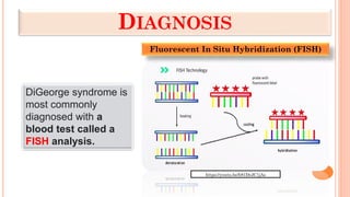 DiGeorge Syndrome (DGS).pdf