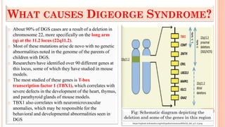 DiGeorge Syndrome (DGS).pdf