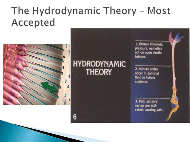 DENTIN HYPERSENSITIVITY - ETIOLOGY, DIAGNOSIS AND TREATMENT | PPT ...