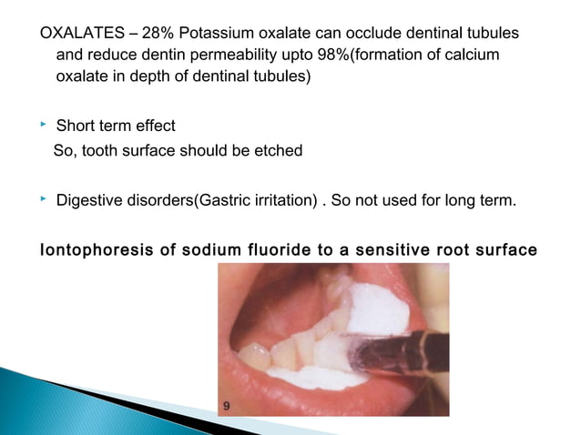 DENTIN HYPERSENSITIVITY - ETIOLOGY, DIAGNOSIS AND TREATMENT | PPT DENTIN HYPERSENSITIVITY - ETIOLOGY, DIAGNOSIS AND TREATMENT | PPT