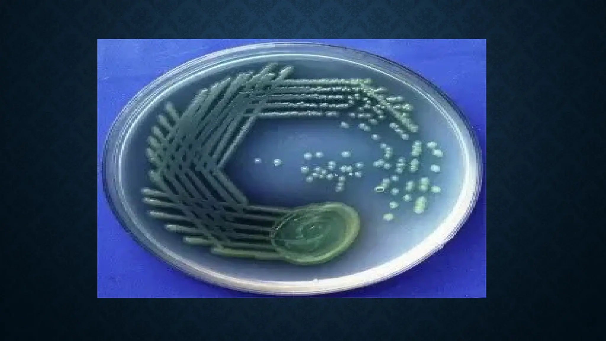 Staphylococcus aureus overview of SlideShare | PPTX