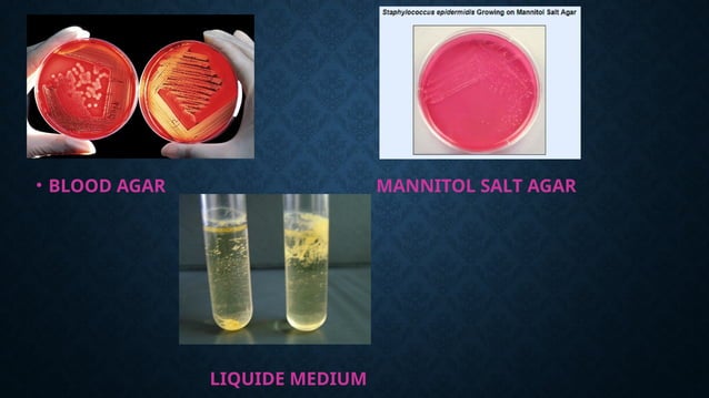 Staphylococcus aureus overview of SlideShare | PPT