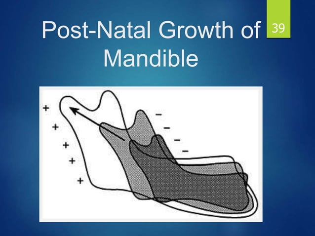 Post-natal Growth of Maxilla and Mandible | PPT | Bone and Joint Conditions | Diseases and ...