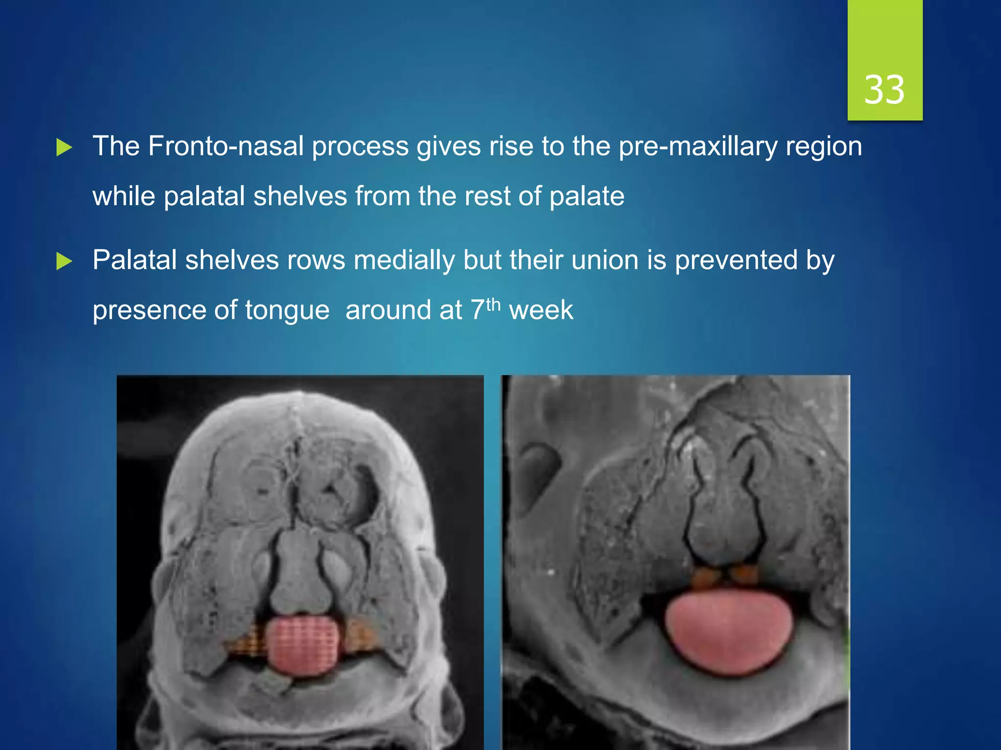 Pre-natal Growth Of Maxilla and Mandible | PPT