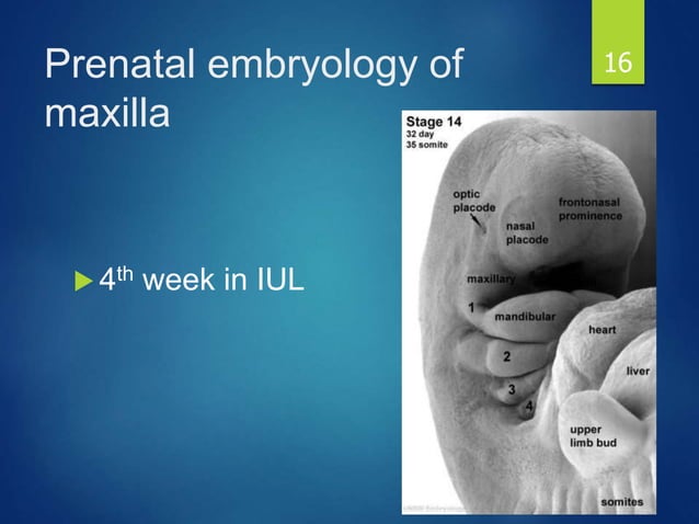 Pre-natal Growth Of Maxilla and Mandible | PPT | Ear, Nose and Throat ...