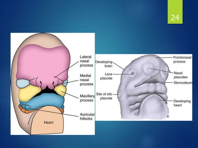 Pre-natal Growth Of Maxilla and Mandible | PPT | Ear, Nose and Throat ...