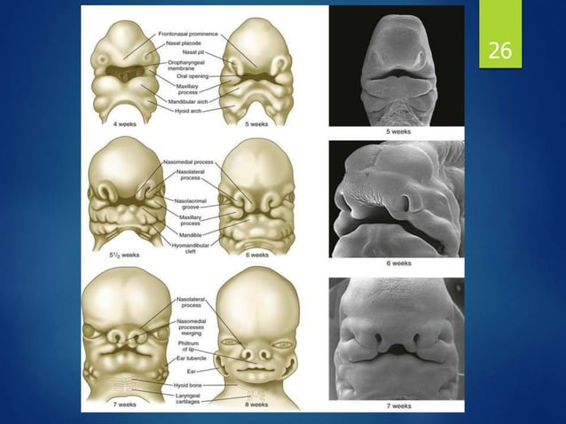 Pre-natal Growth Of Maxilla and Mandible | PPT | Ear, Nose and Throat ...