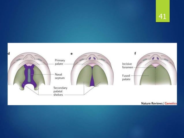 Pre-natal Growth Of Maxilla and Mandible | PPT | Ear, Nose and Throat ...