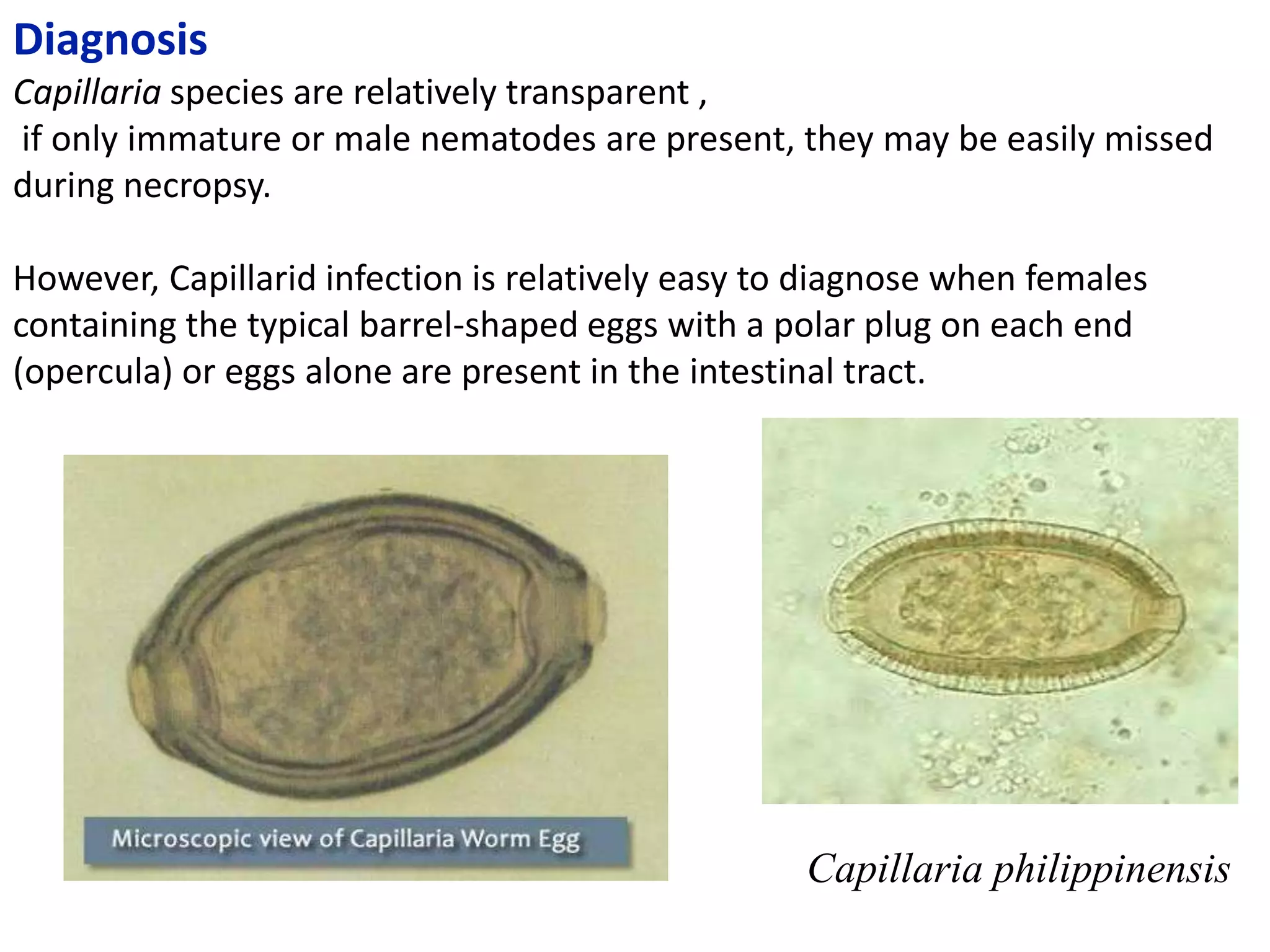 Nematodes in Fisheries | PPTX