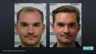 DHI Evolution of hair transplant presentation | PPTX