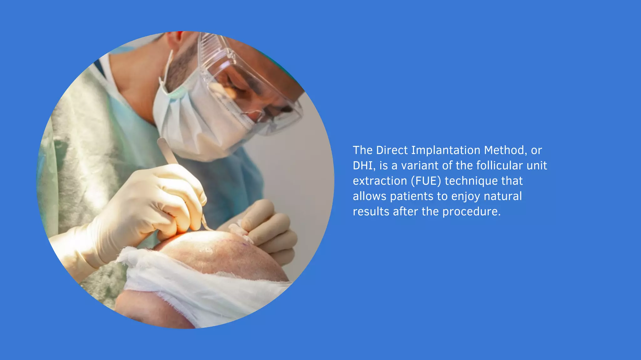 DHI Hair Transplant Turkey | PPT