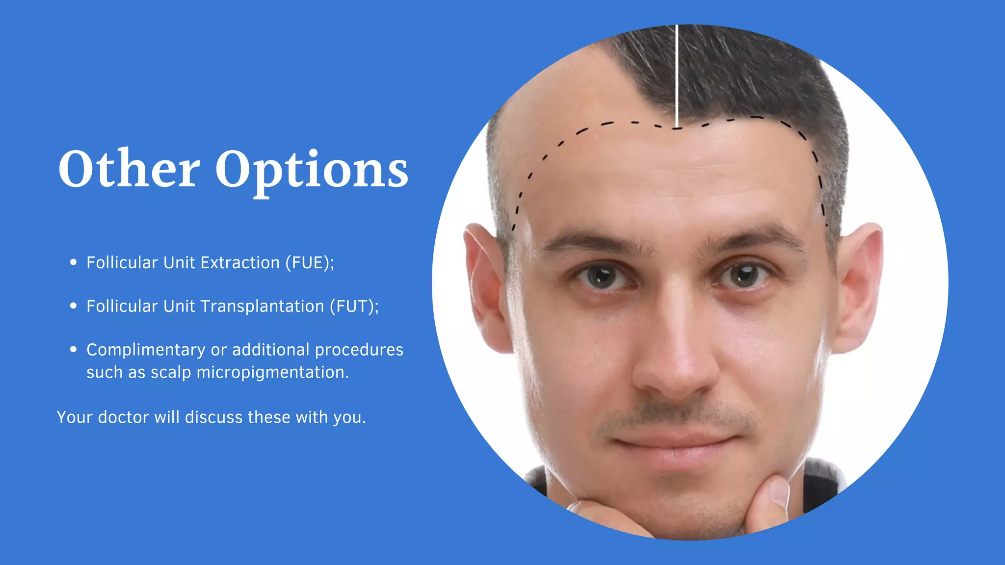 DHI Hair Transplant Turkey | PPT