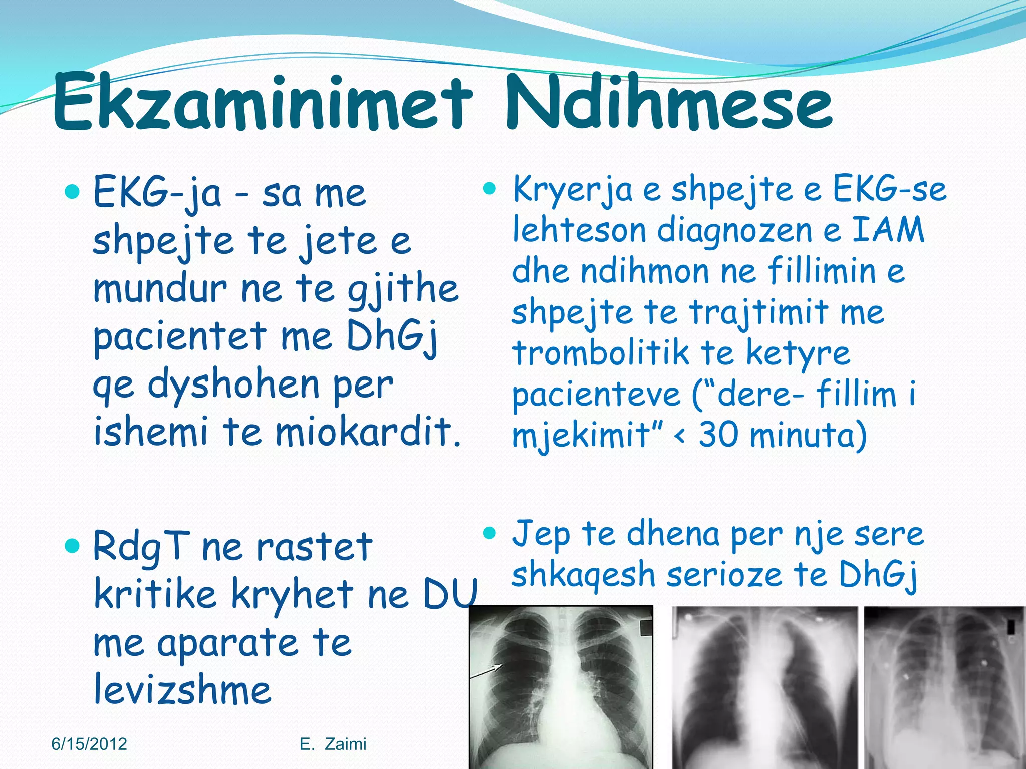 Dhimbja e gjoksit | PPSX