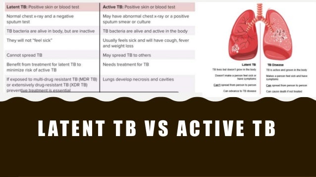 Tuberculosis ( latent and active) | PPTX