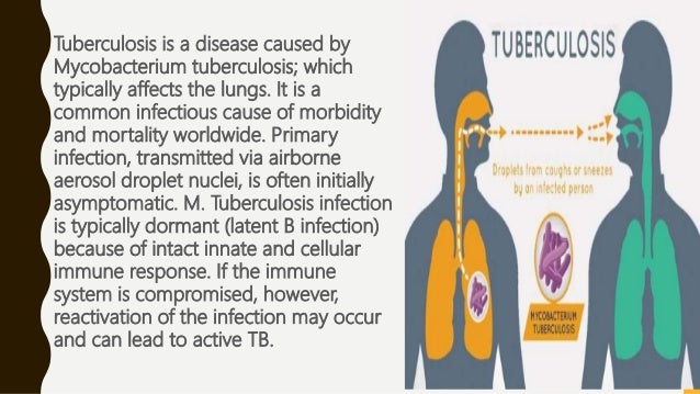 Tuberculosis ( latent and active) | PPTX