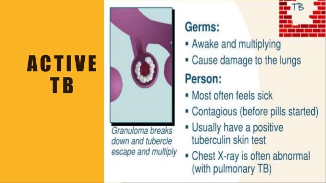 Tuberculosis ( latent and active) | PPTX