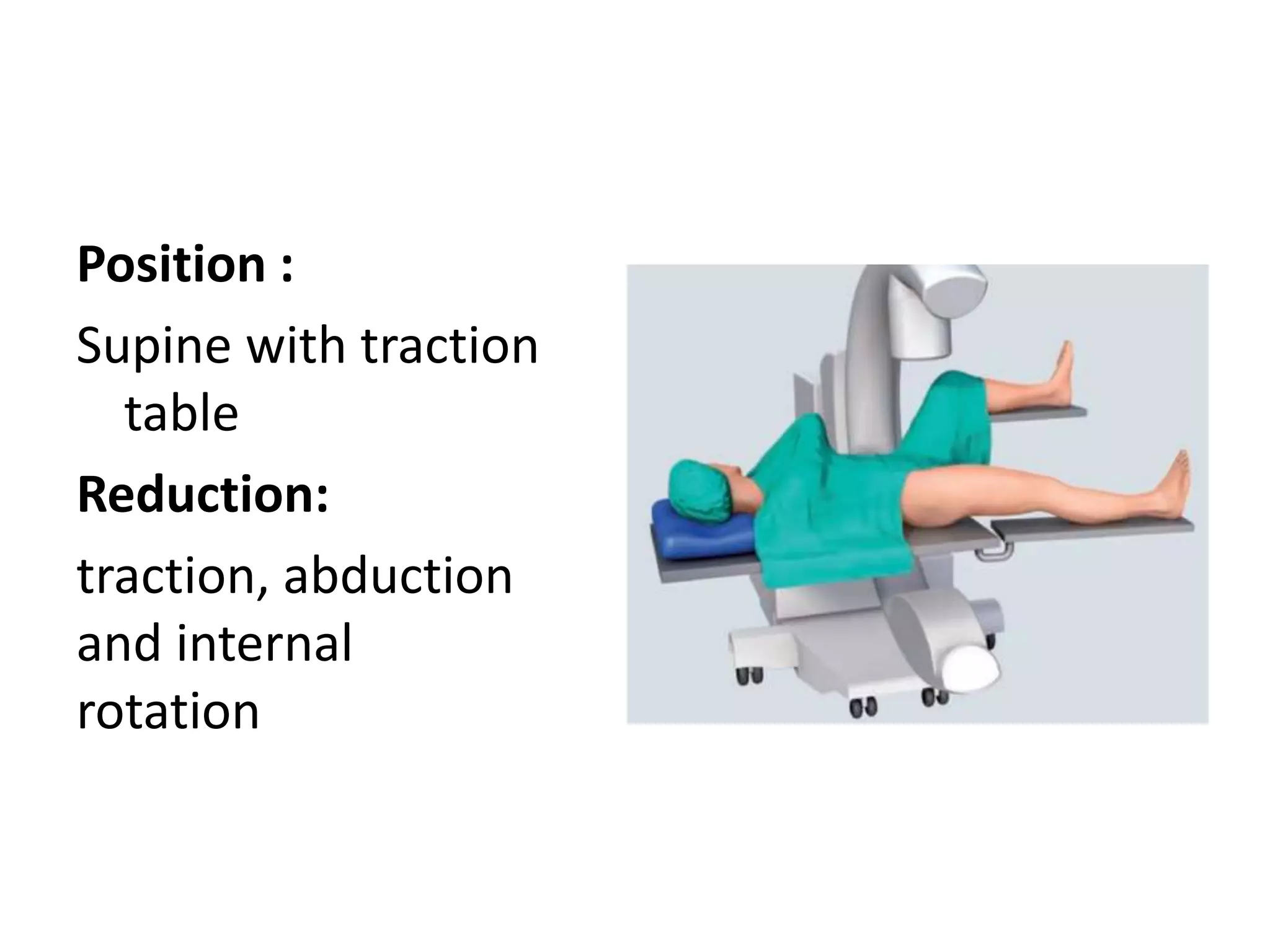 Dynamic hip screw with Trochanteric Stabilization plate Case ...
