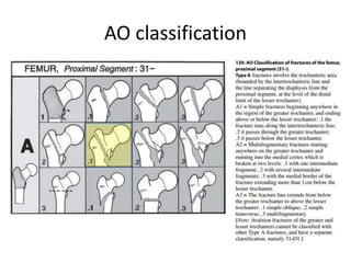 Dynamic hip screw with Trochanteric Stabilization plate Case ...