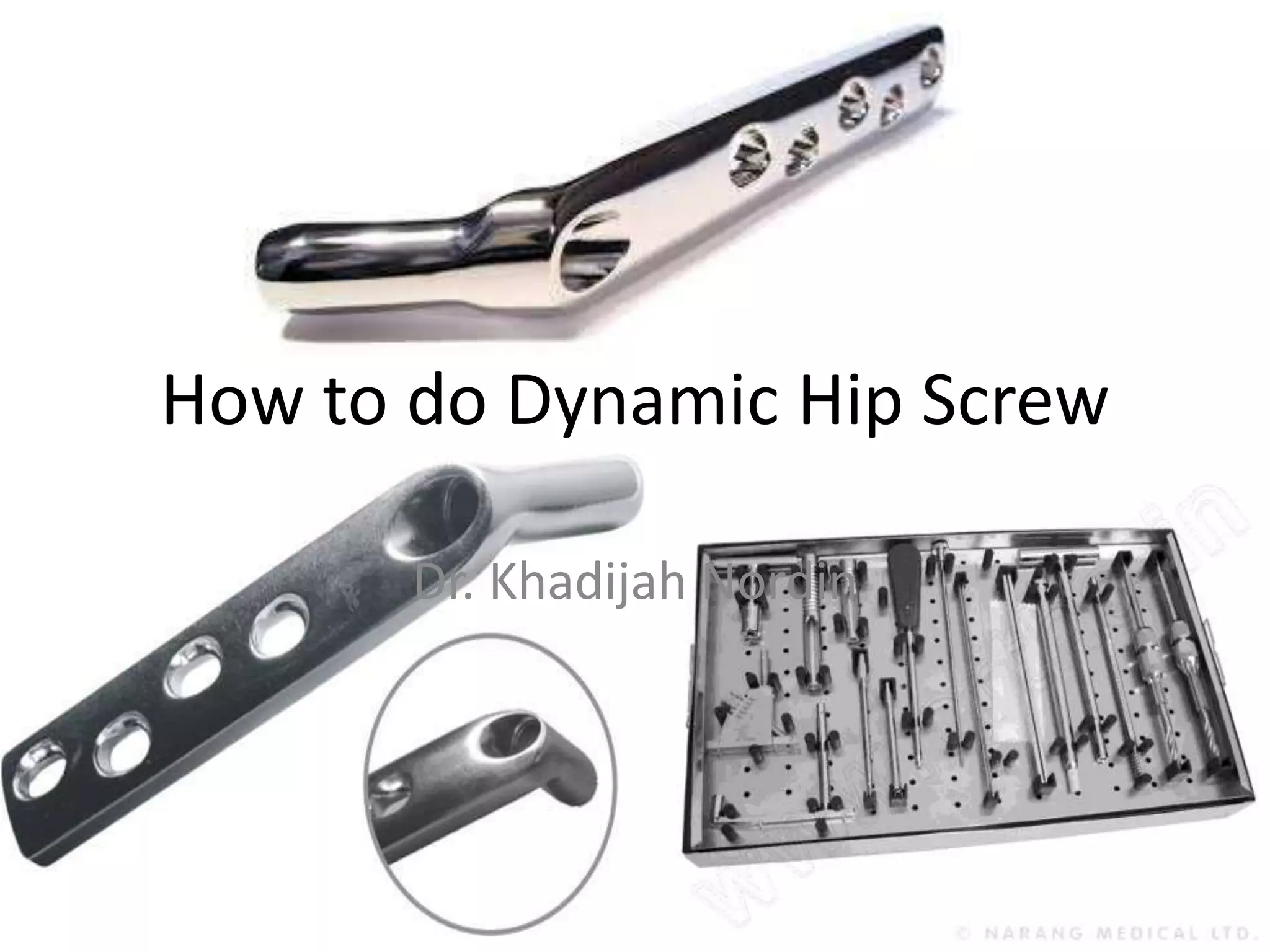 dynamic hip screw | PPTX