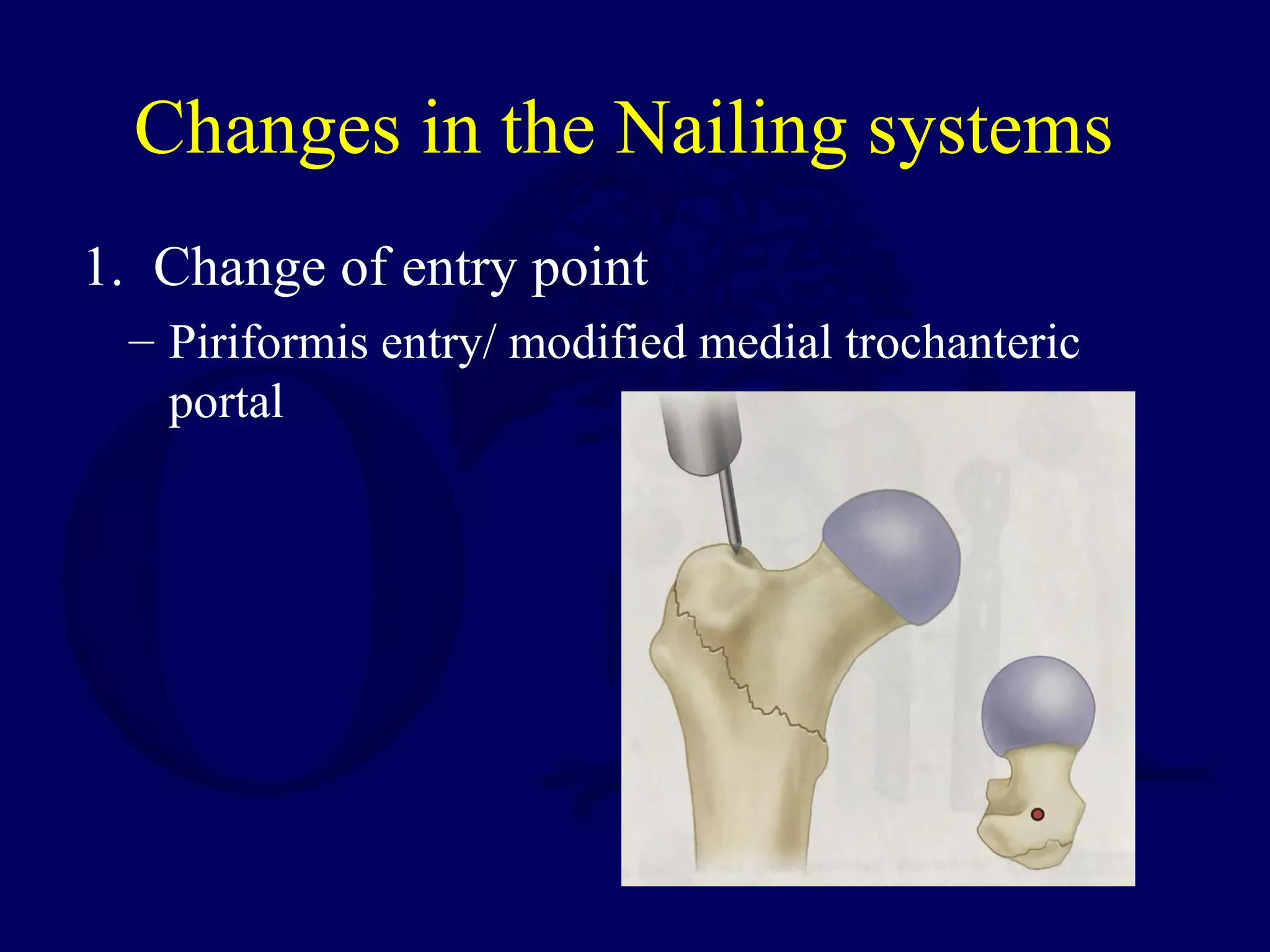 DHS vs PFNA for Intertrochanteric fractures - Dr Chintan N Patel | PPT
