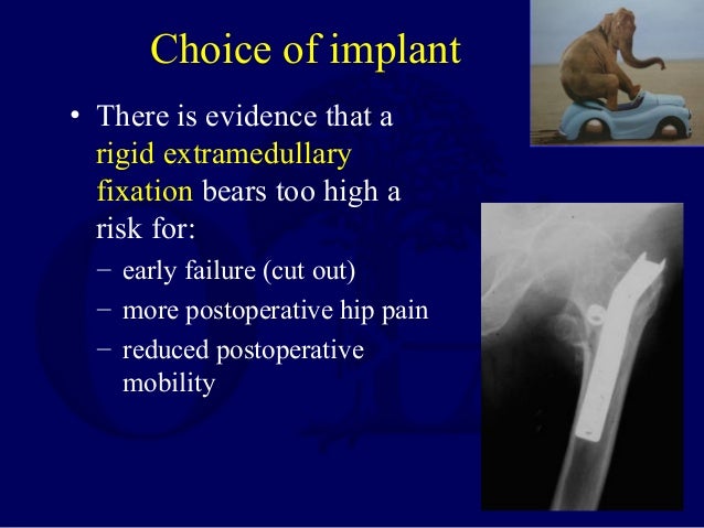 DHS vs PFNA for Intertrochanteric fractures - Dr Chintan N Patel