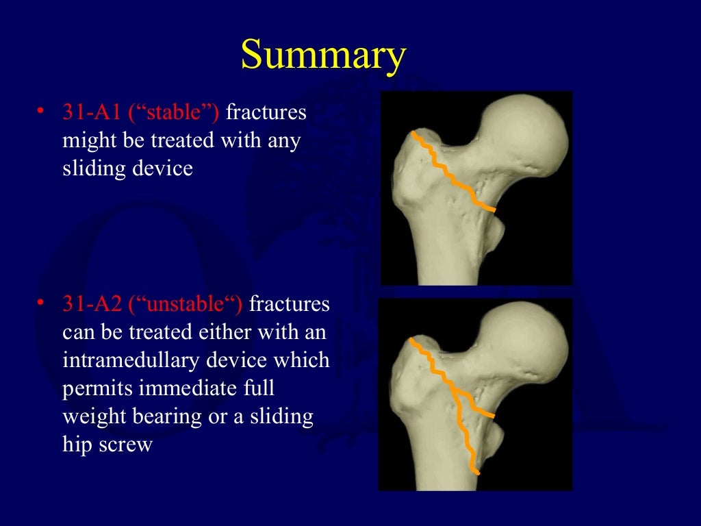 DHS vs PFNA for Intertrochanteric fractures - Dr Chintan N Patel