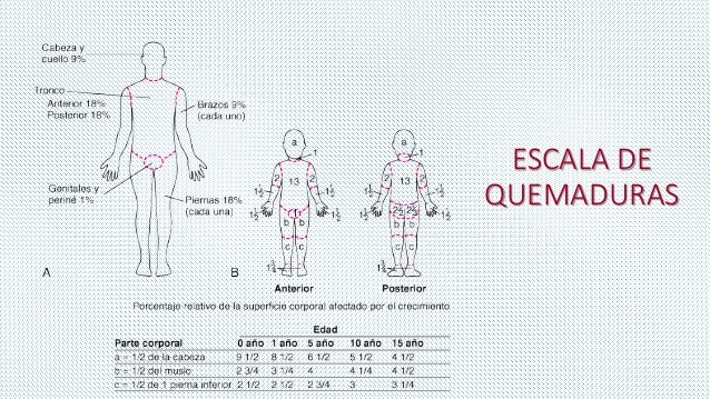 Manejo Integral Fisioterapeutico del Paciente Pediátrico Quemado