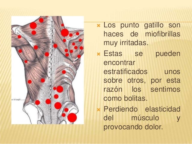 Qué Es La Zona Gatillo _ Puntos Gatillo Activo – BDNE