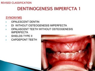 Dentinogenesis Imperfecta | PPTX