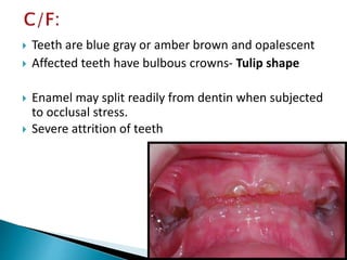 Dentinogenesis Imperfecta | PPTX
