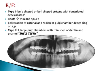 Dentinogenesis Imperfecta | PPTX