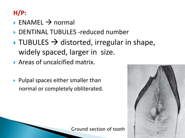 Dentinogenesis Imperfecta | PPTX
