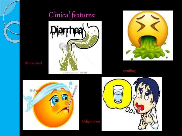Acute Diarrhoeal Disease ppt | PPTX