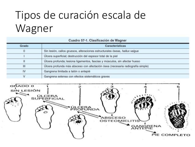 pie diabetico (wagner)