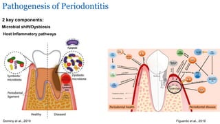 Diabetes and Periodontal Disease | PPTX