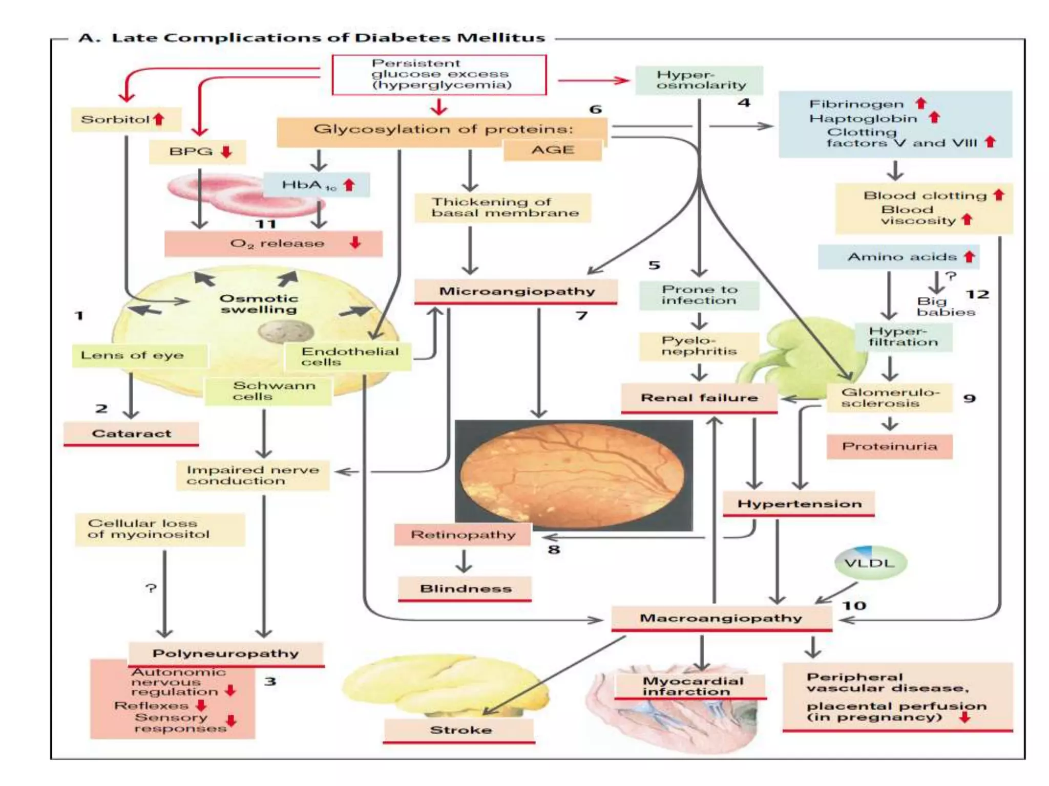 screening model for diabetes | PPTX
