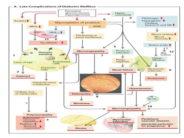screening model for diabetes | PPTX